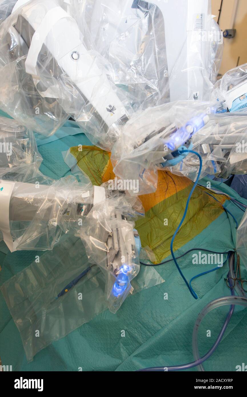 Da Vinci Robotic prostatectomy (removal of all or part of the prostate ...