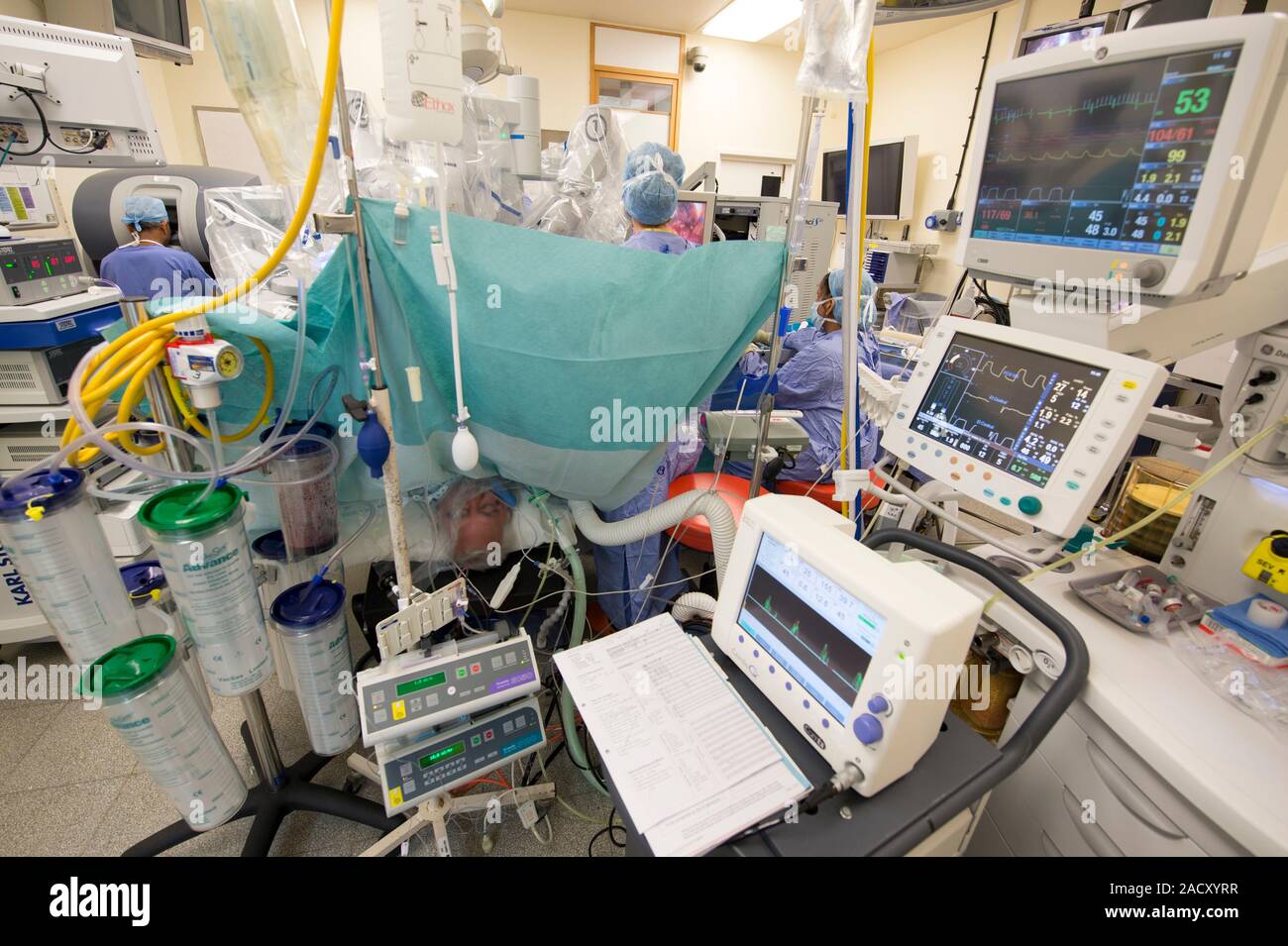 Da Vinci Robotic prostatectomy (removal of all or part of the prostate gland). The Da Vinci ...