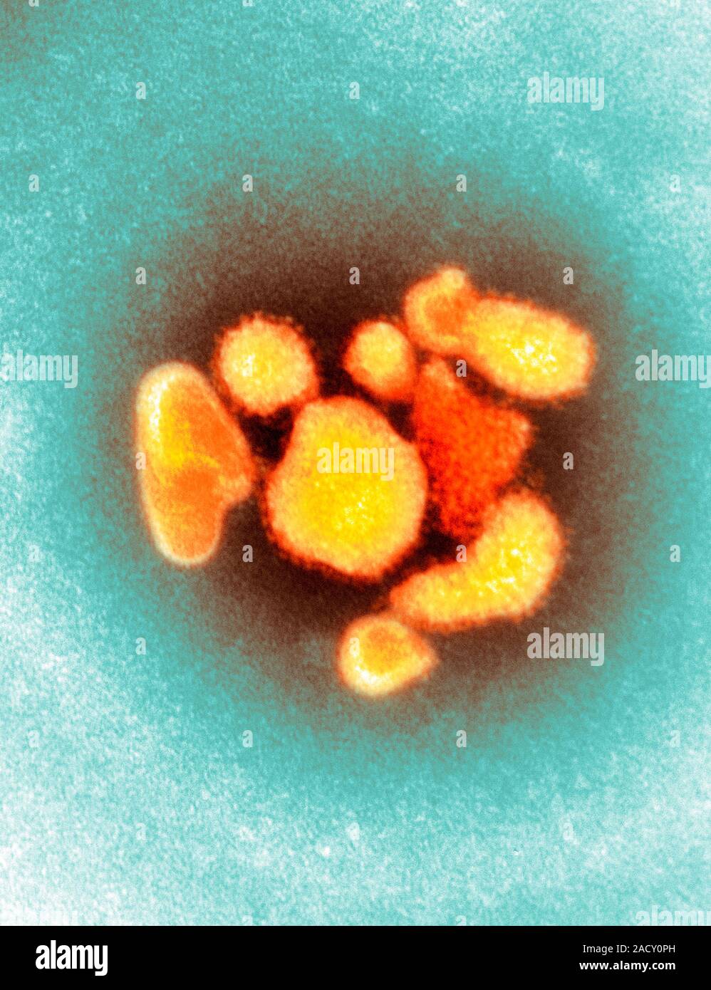 Arenavirus virus particles. Coloured transmission electron micrograph ...