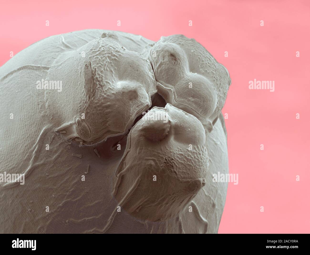 Ascaris roundworm, coloured environmental scanning electron micrograph ...