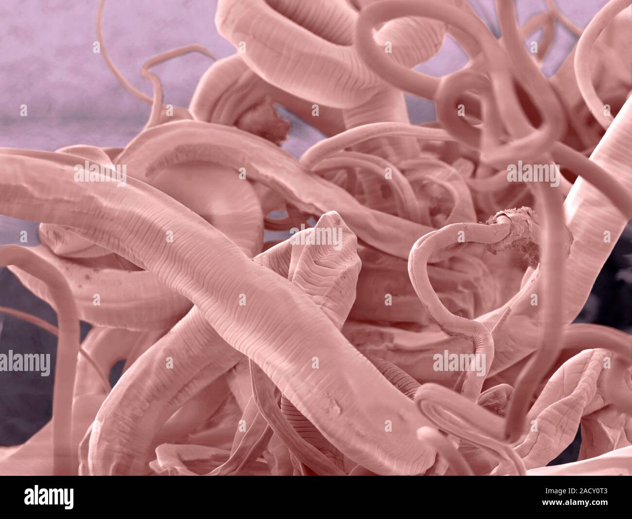 Trichuris whipworms, coloured environmental scanning electron ...