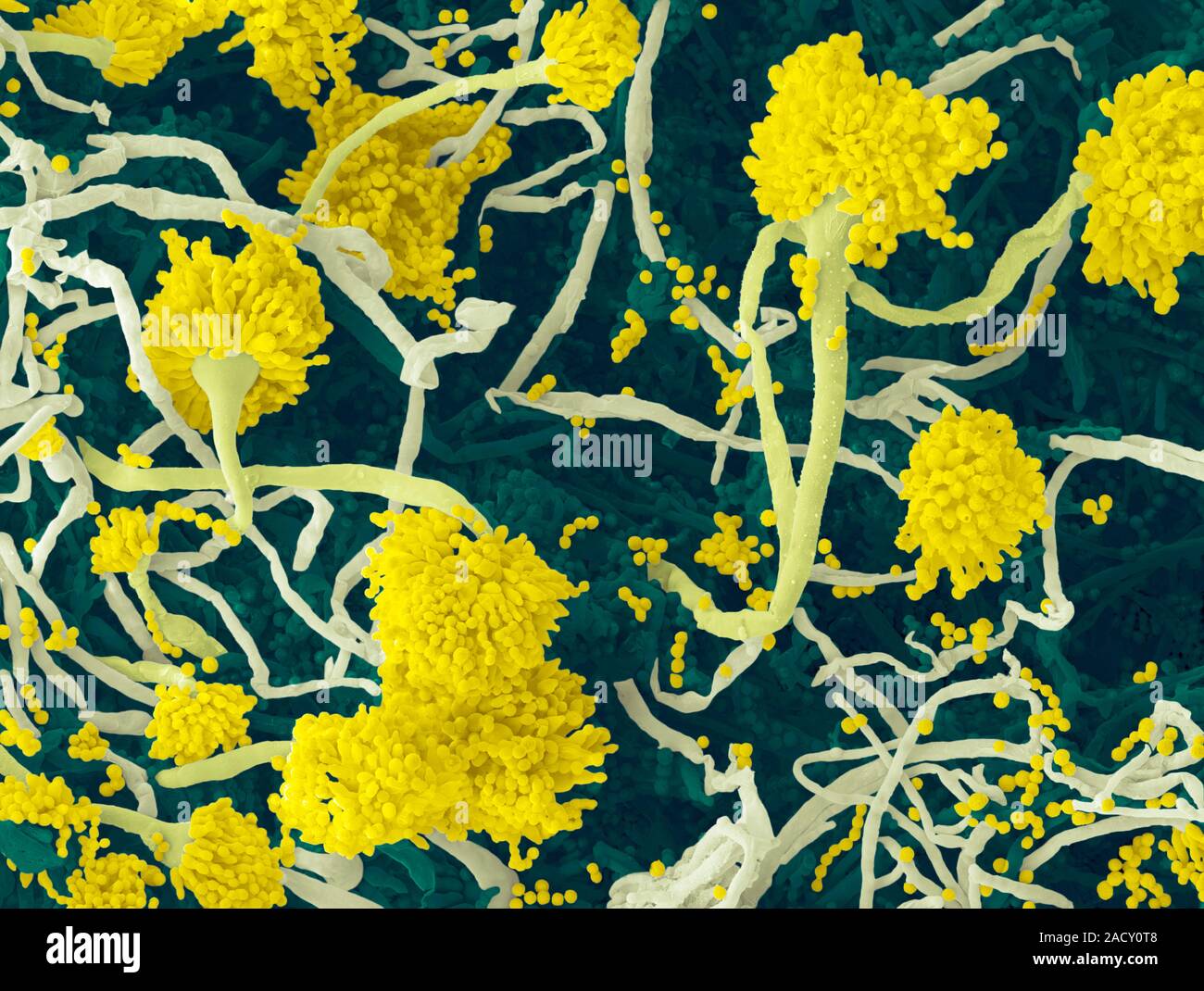 Aspergillus fungus conidiophores, coloured environmental scanning ...