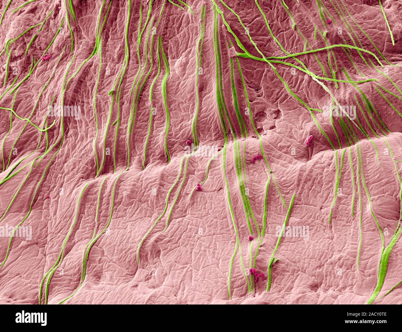 Microsporum canis infection, coloured environmental scanning electron ...
