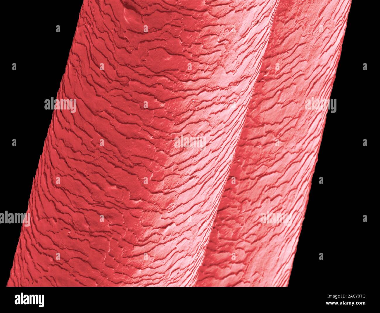 Human hairs. Coloured environmental scanning electron micrograph (ESEM ...