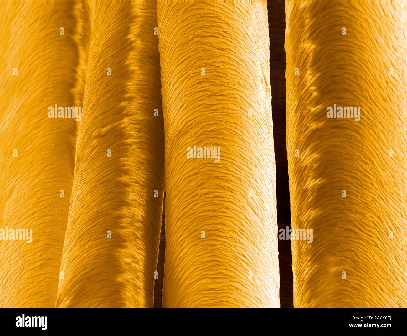 Human hairs. Coloured environmental scanning electron micrograph (ESEM ...