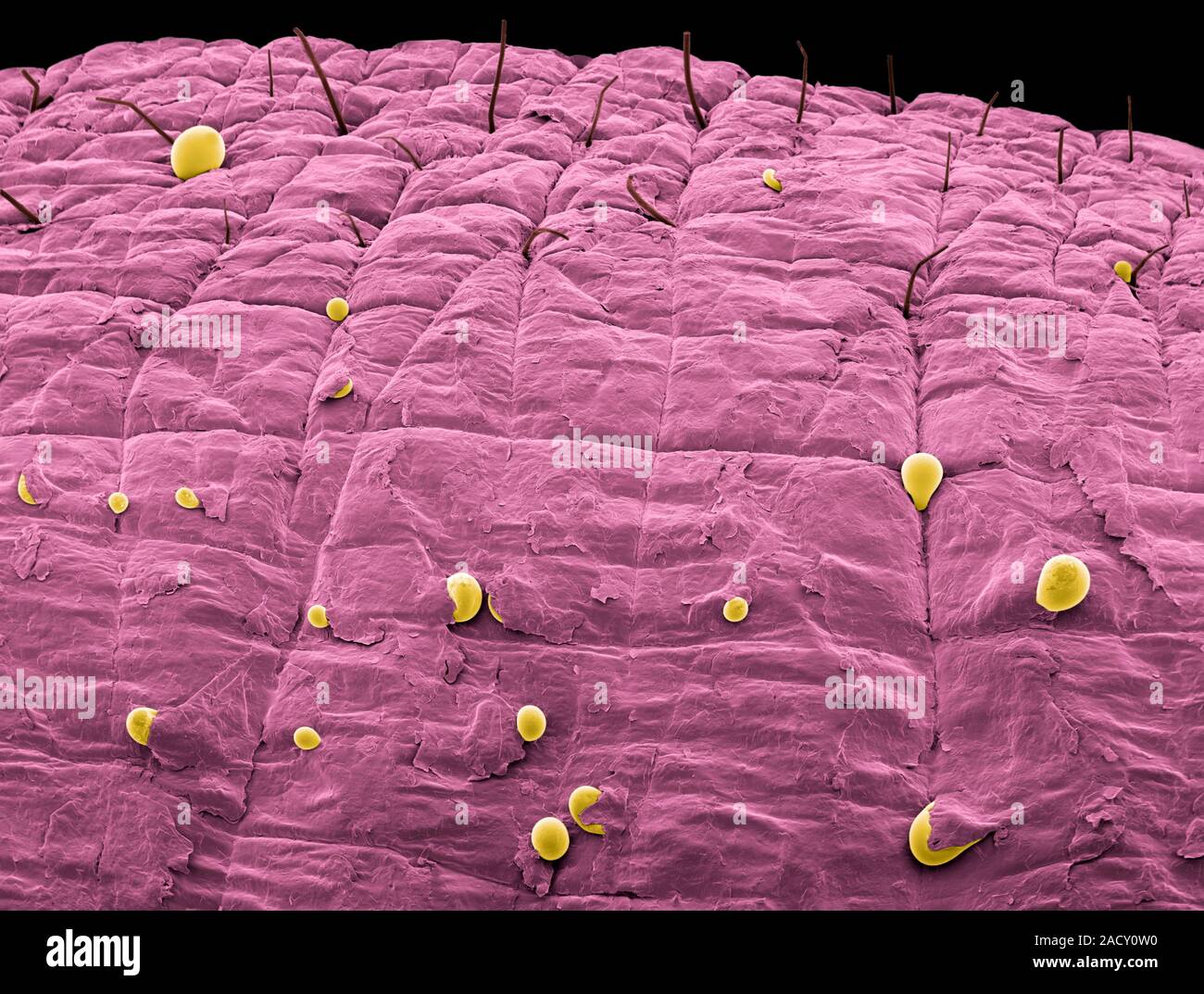 Lip skin, coloured environmental scanning electron micrograph (ESEM ...