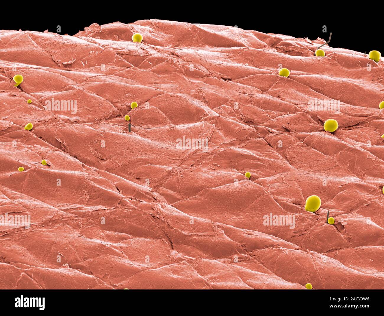 Human skin, coloured environmental scanning electron micrograph (ESEM ...