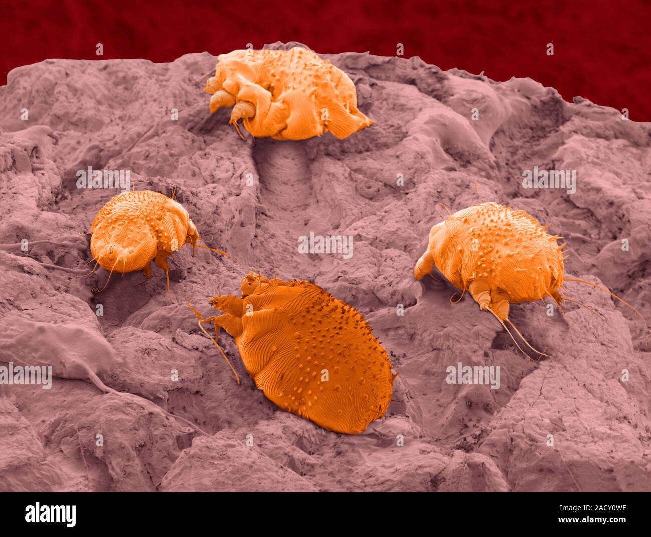 Sarcoptes parasitic mites, coloured environmental scanning electron ...