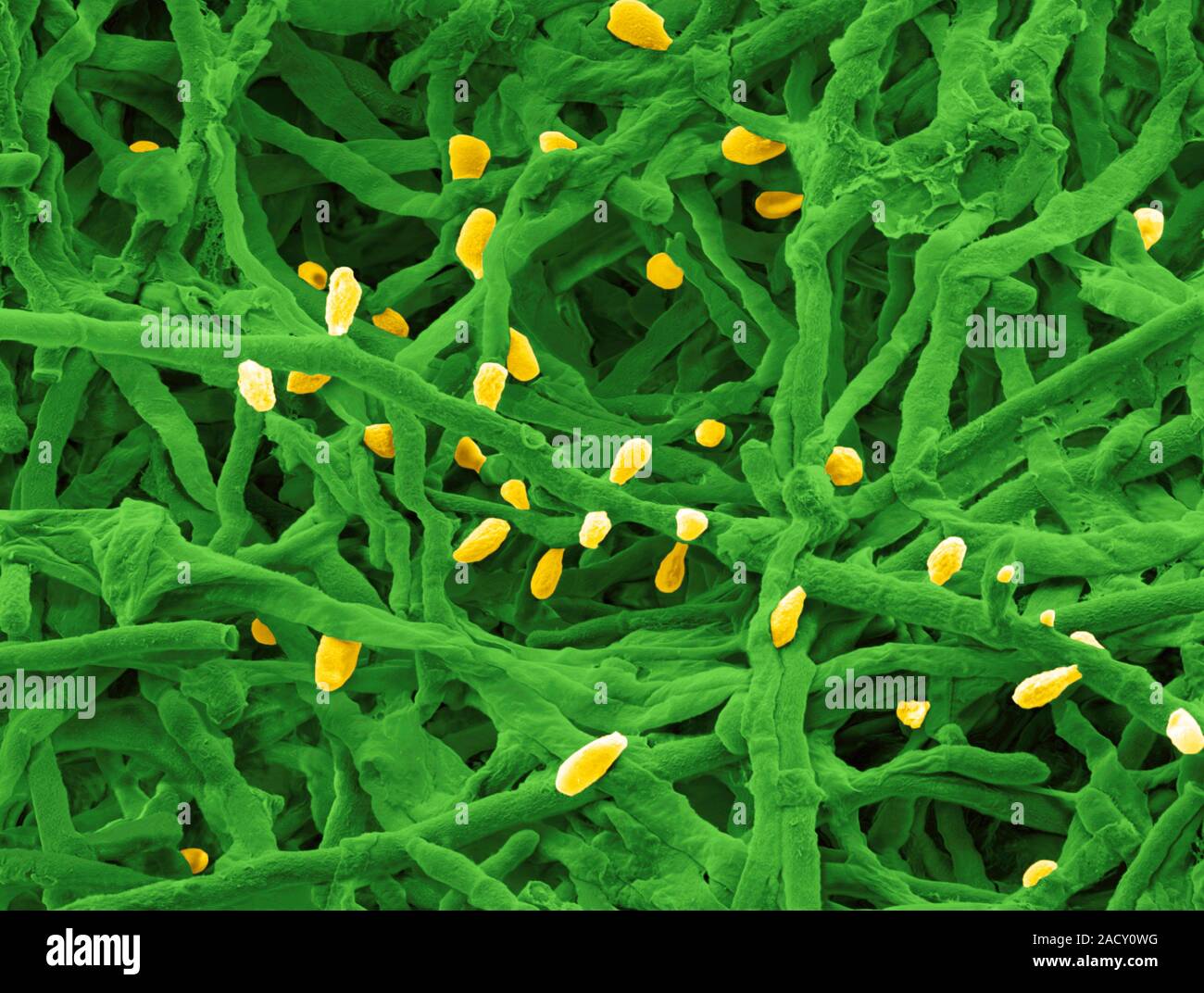 Trichophyton fungus, coloured environmental scanning electron ...