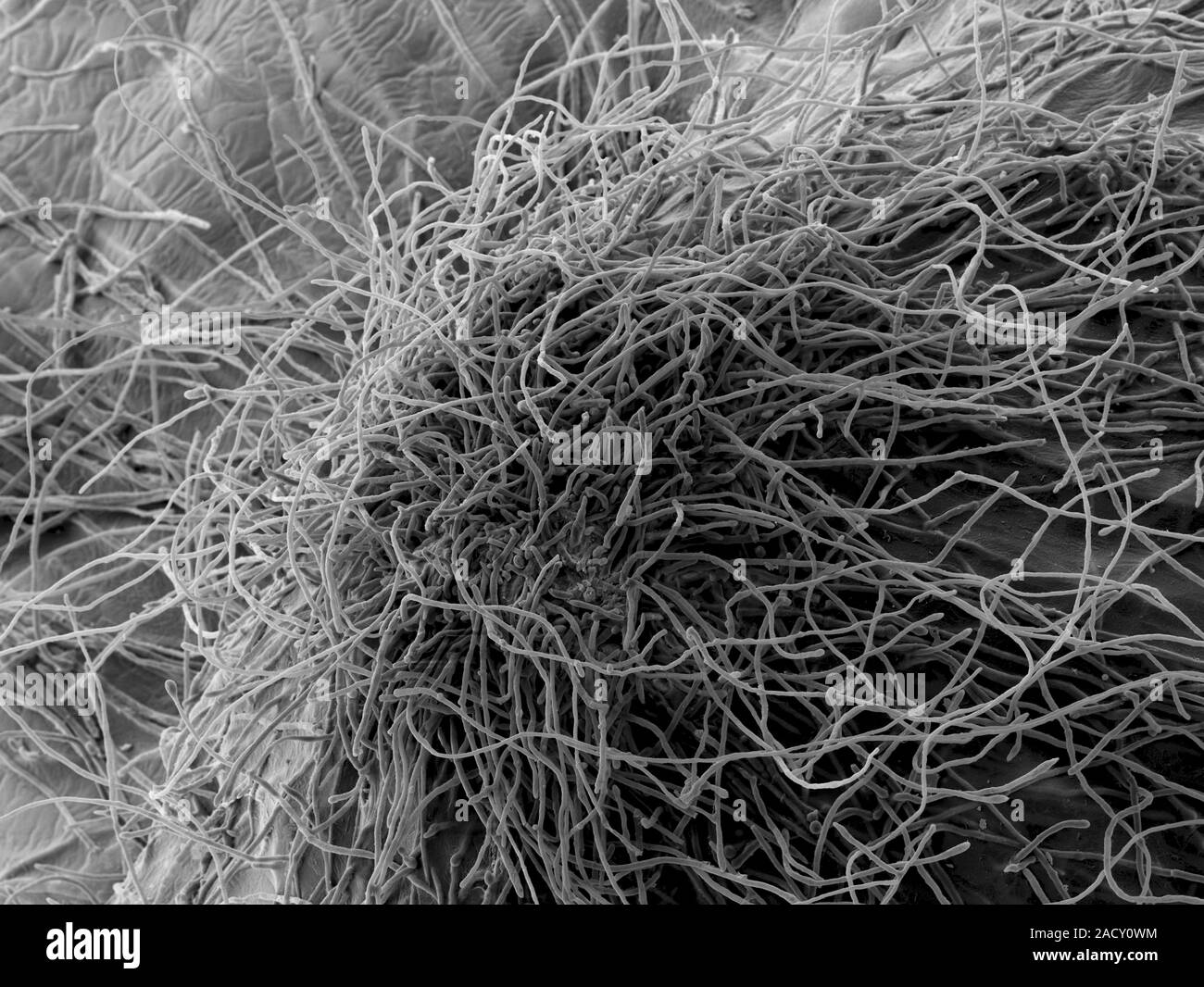Trichophyton fungus, environmental scanning electron micrograph (ESEM ...