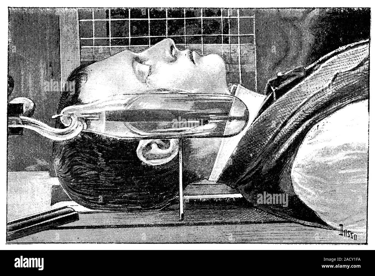 Fluoroscopy experiment. 19th-century artwork of an early fluoroscope ...