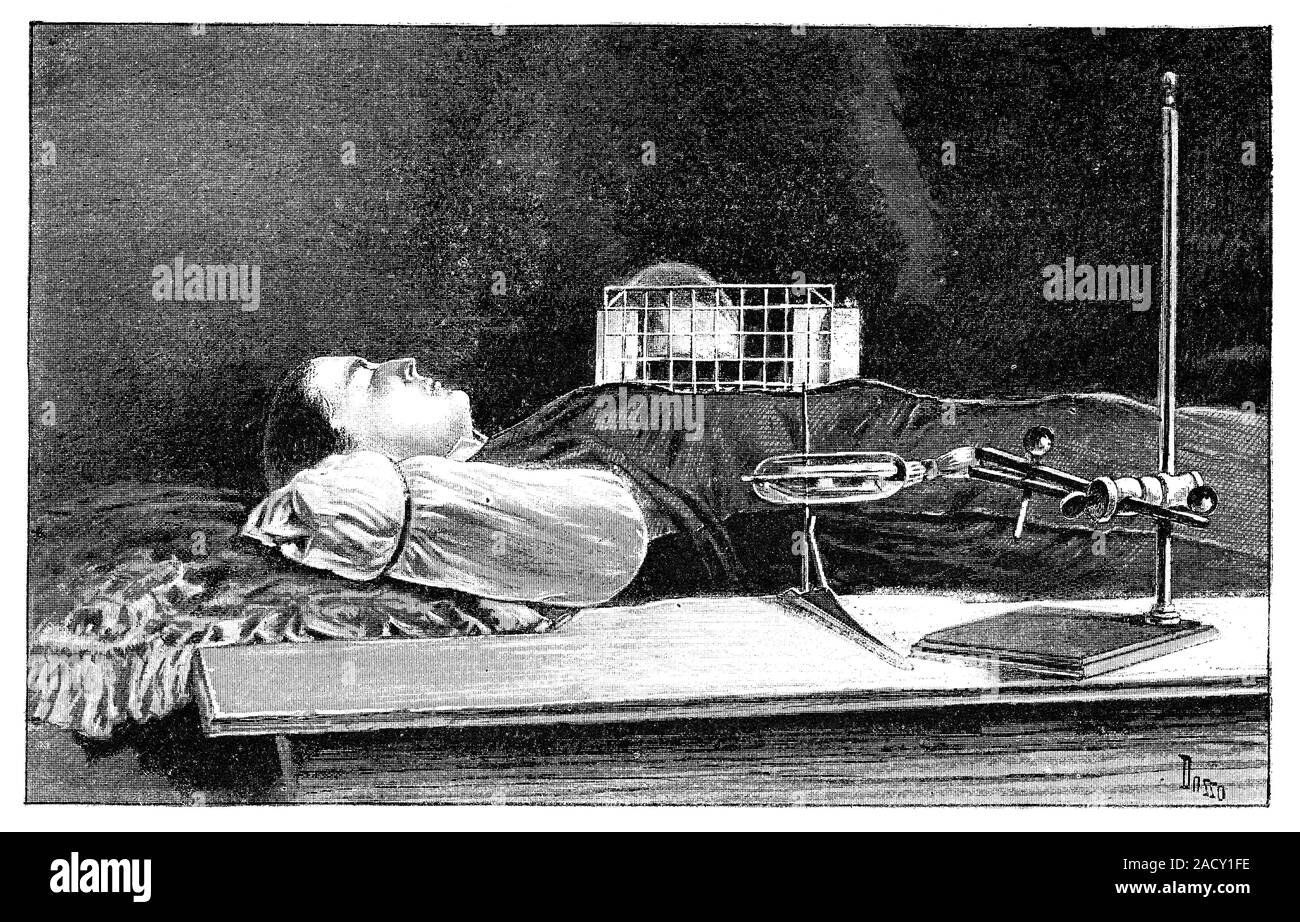 Fluoroscopy experiment. 19th-century artwork of an early fluoroscope ...