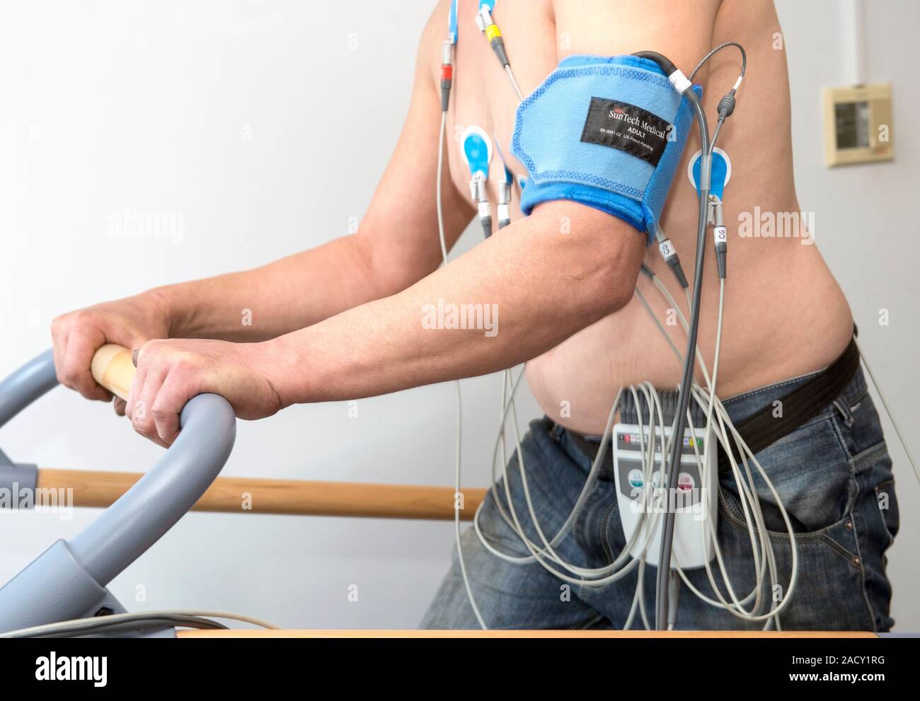Exercise Ecg A Man Undergoing Exercise Testing On A Treadmill Whilst An Electrocardiograph