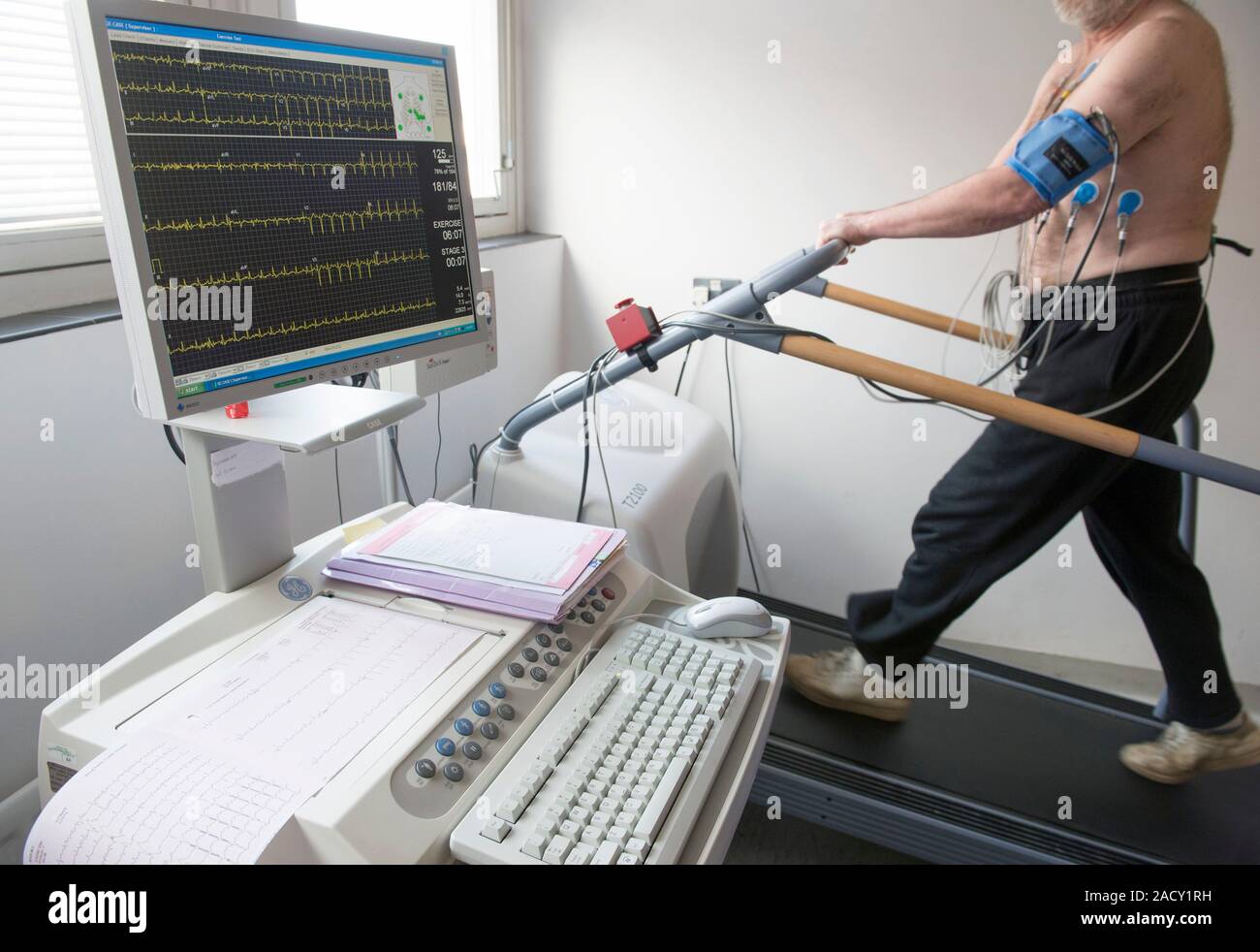 Exercise Ecg A Man Undergoing Exercise Testing On A Treadmill Whilst An Electrocardiograph