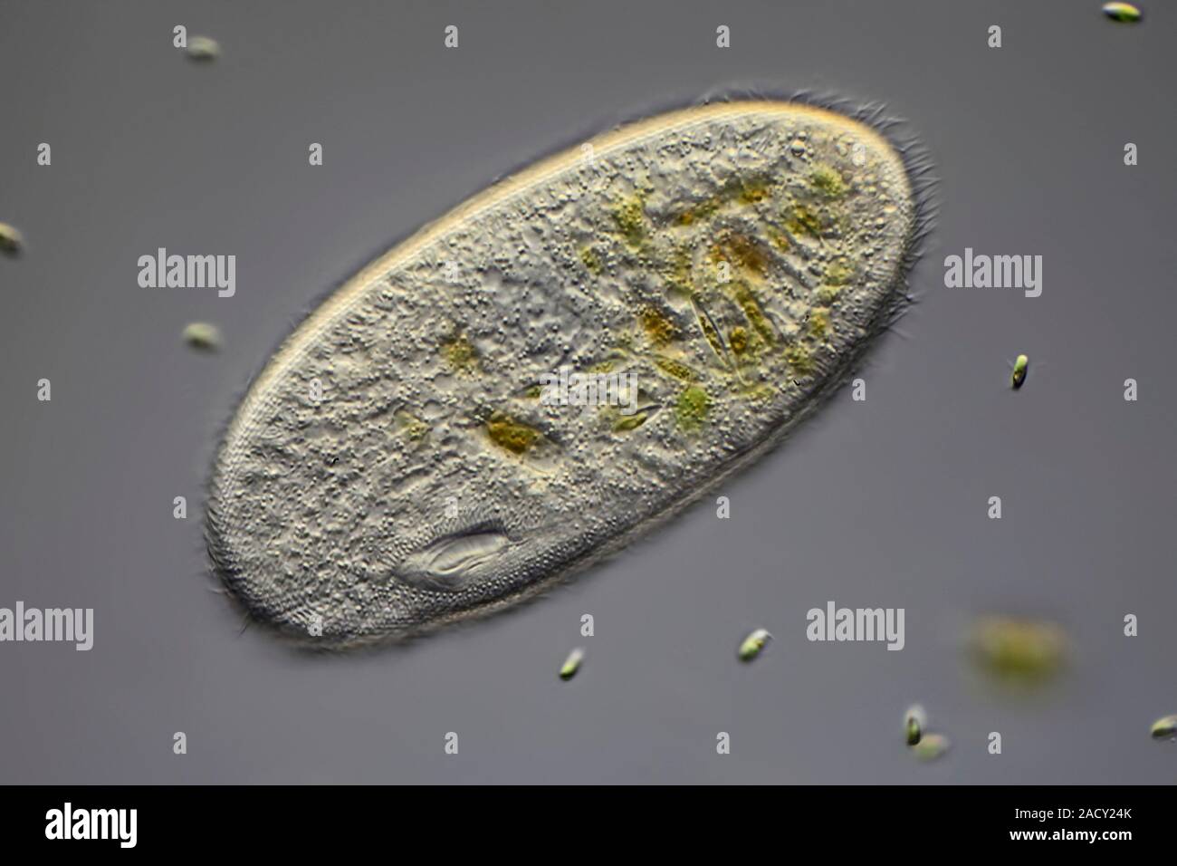 Ciliate protozoan. Differential interference contrast (DIC) light ...
