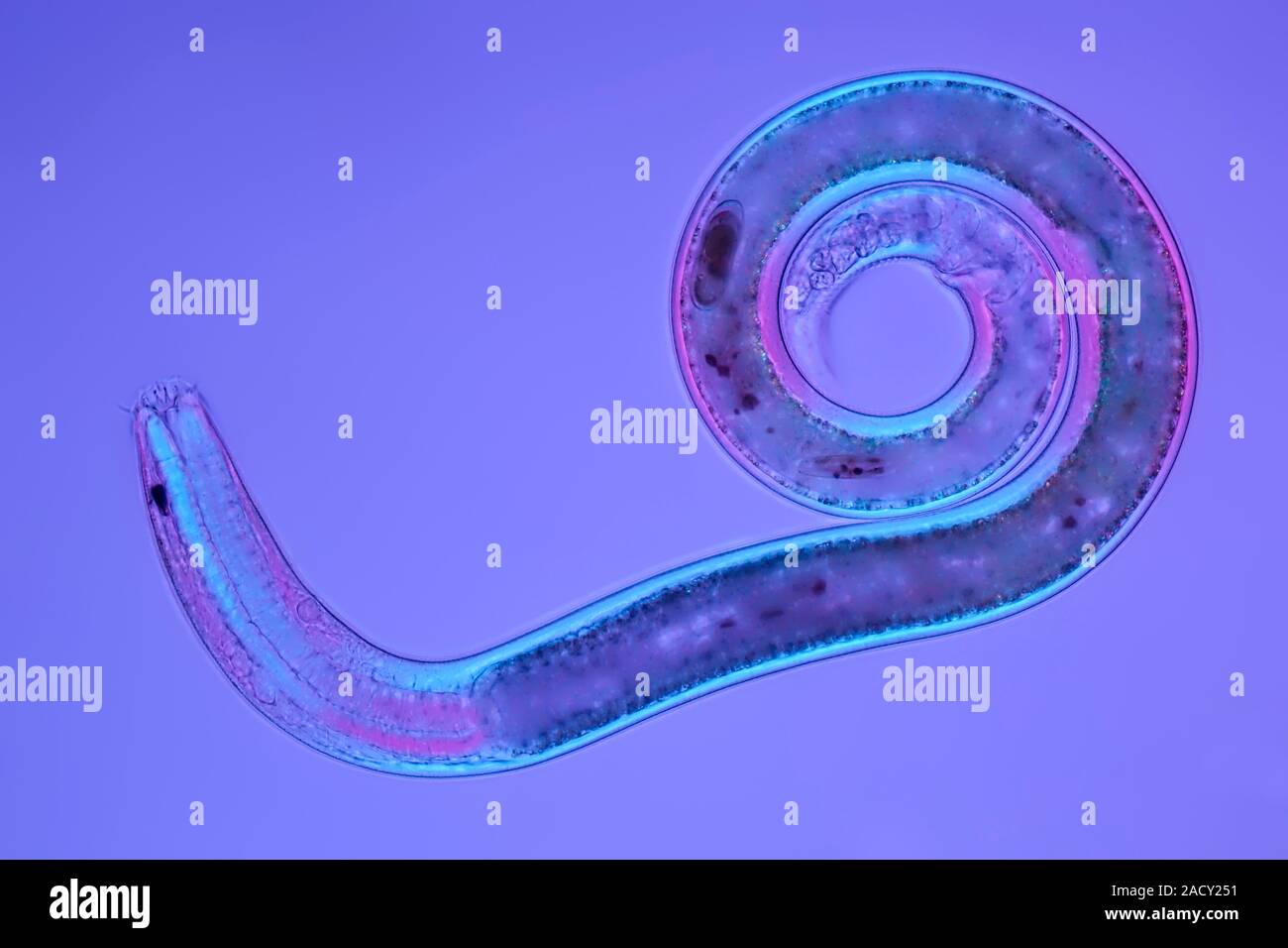Nematode, or roundworm, polarised illuminated light micrograph ...