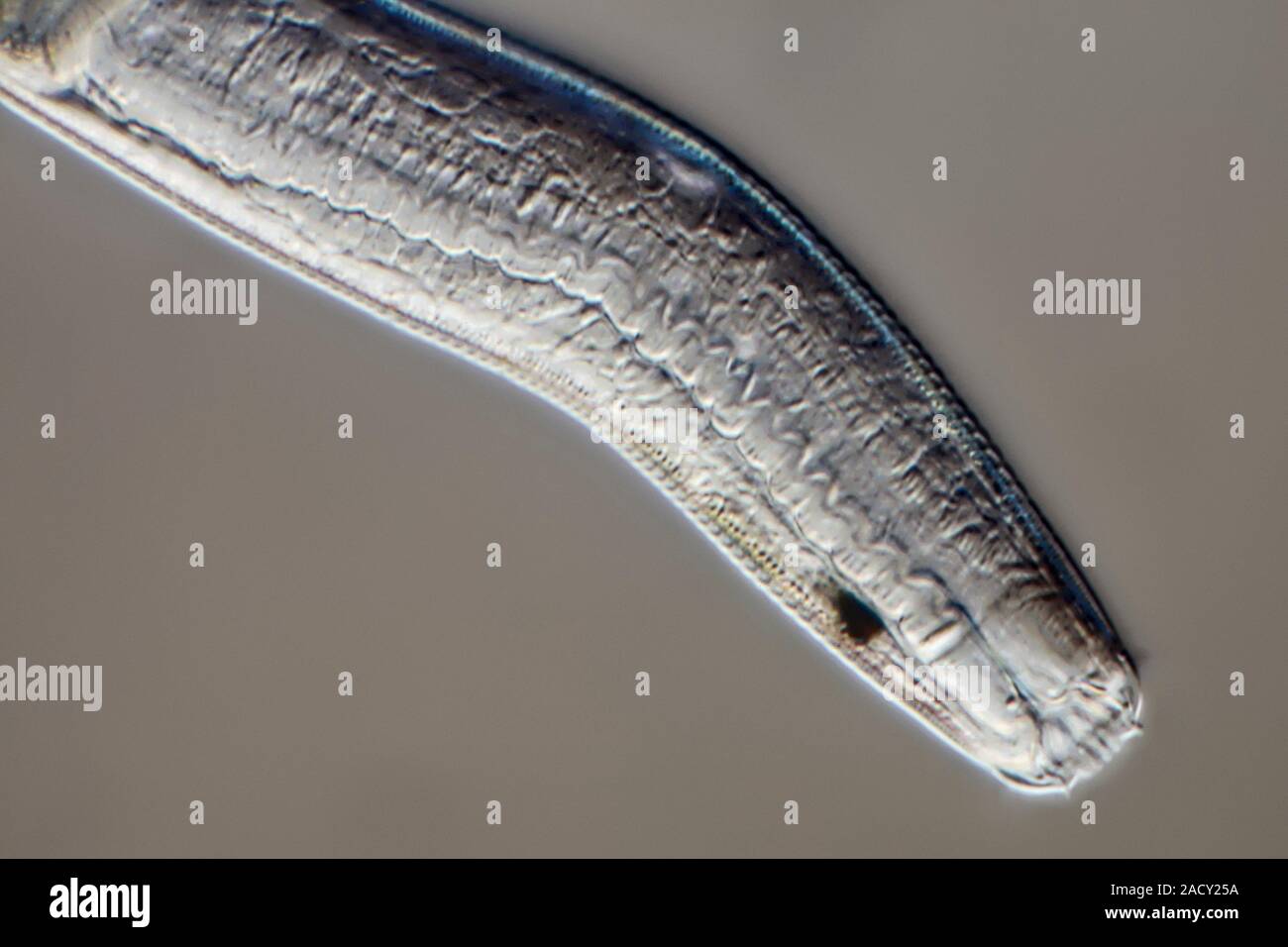 Nematode, or roundworm, differential interference contrast (DIC) light ...