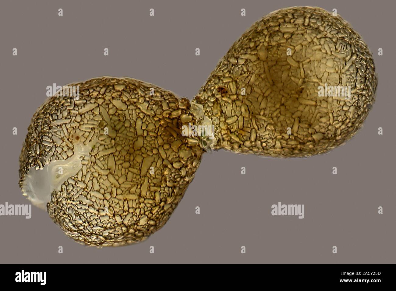 Amoeba Shells Differential Interference Contrast Dic Light