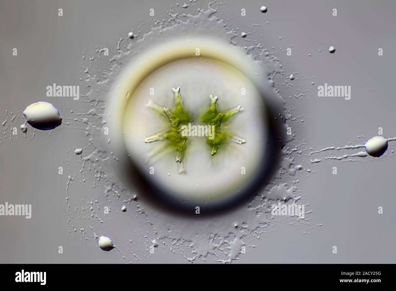 Green algae (Staurastrum arctiscon) differential interference contrast ...