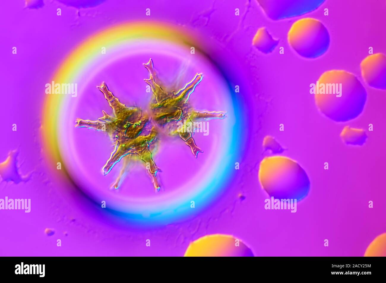 Green algae (Staurastrum arctiscon) differential interference contrast ...