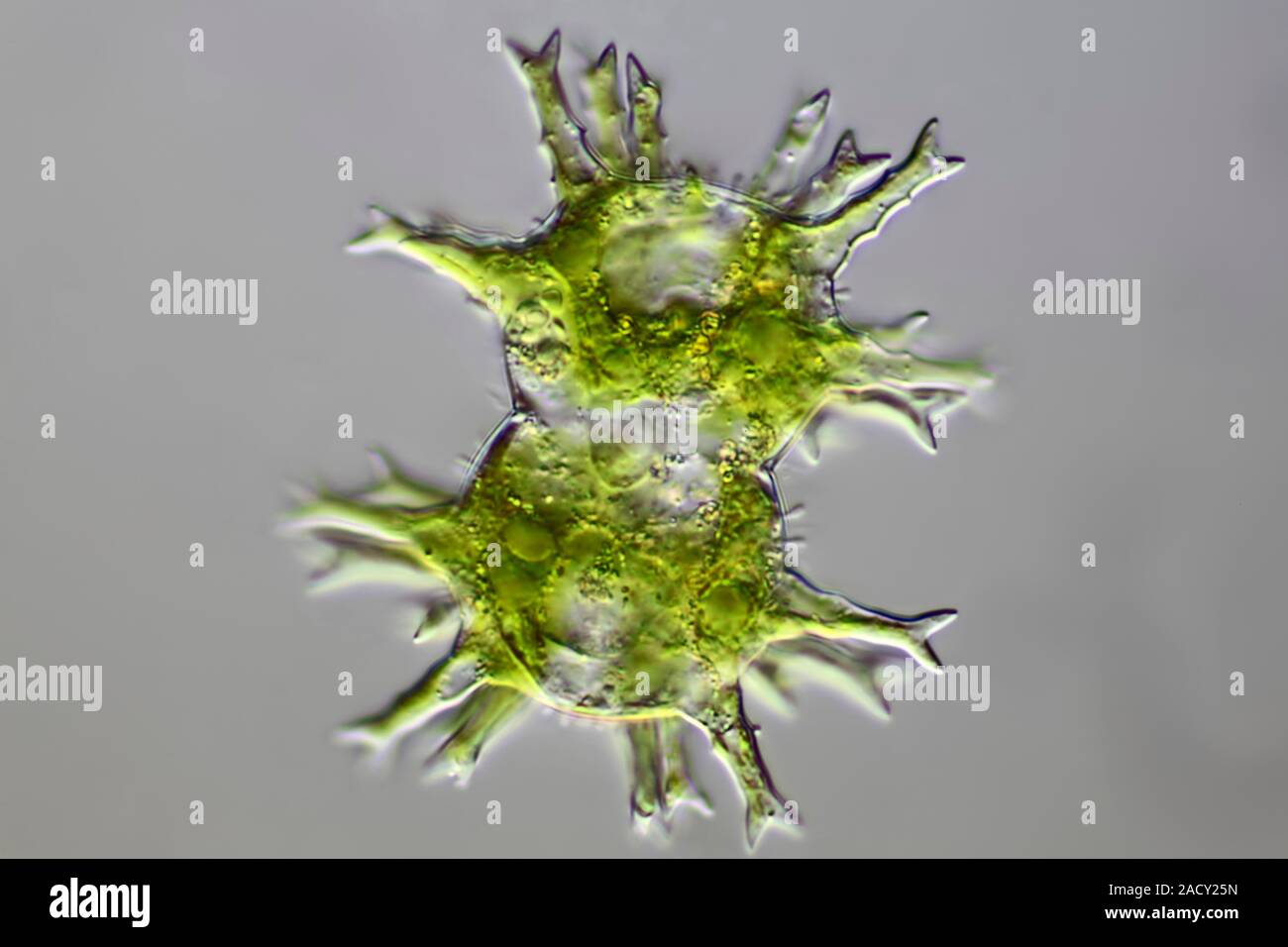 Green algae (Staurastrum arctiscon) differential interference contrast ...