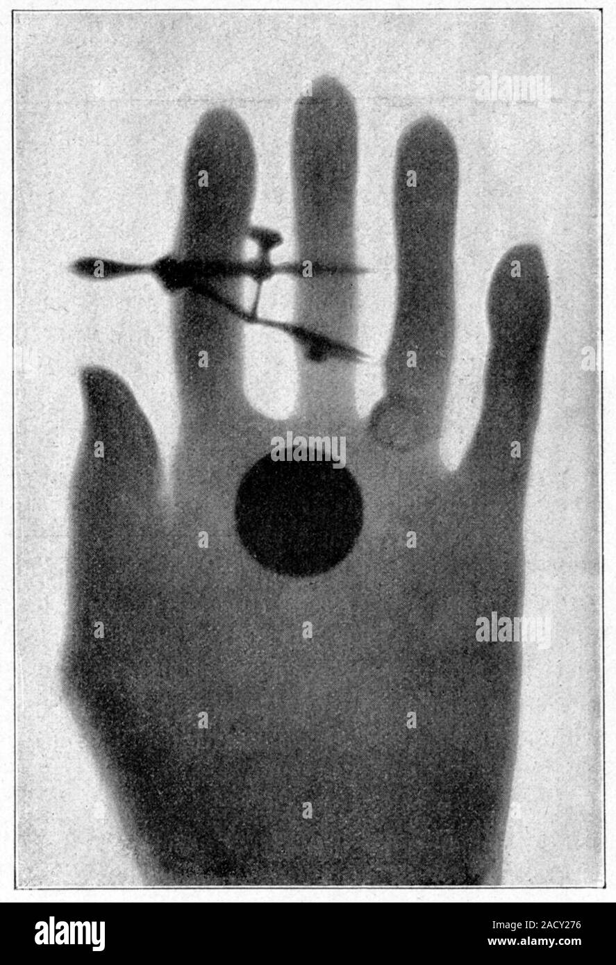 Female hand. 19th Century radium ray image of the hand of the German ...