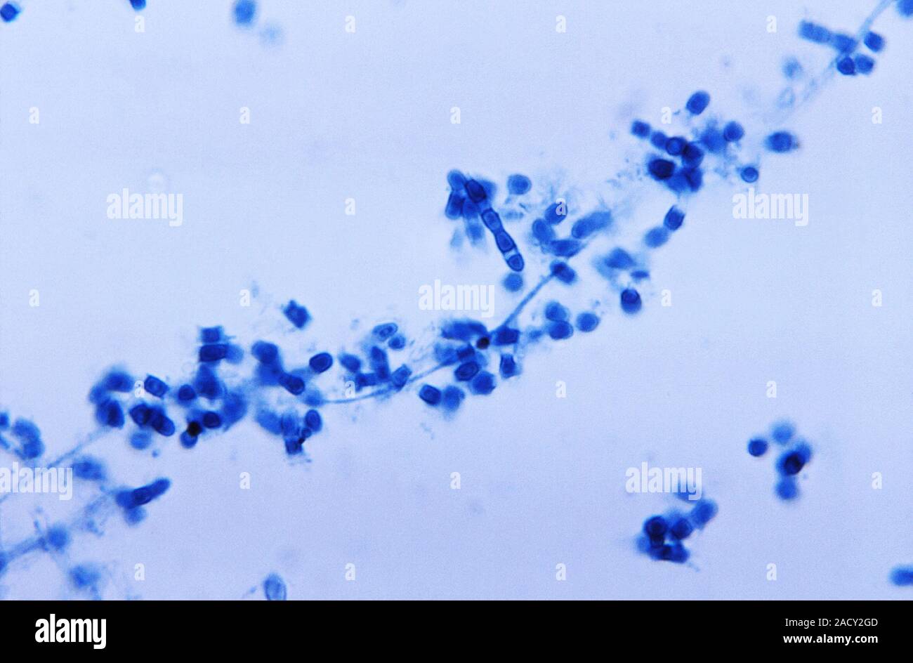 Coccidioidomycosis fungus. Light micrograph of numerous thick-walled ...