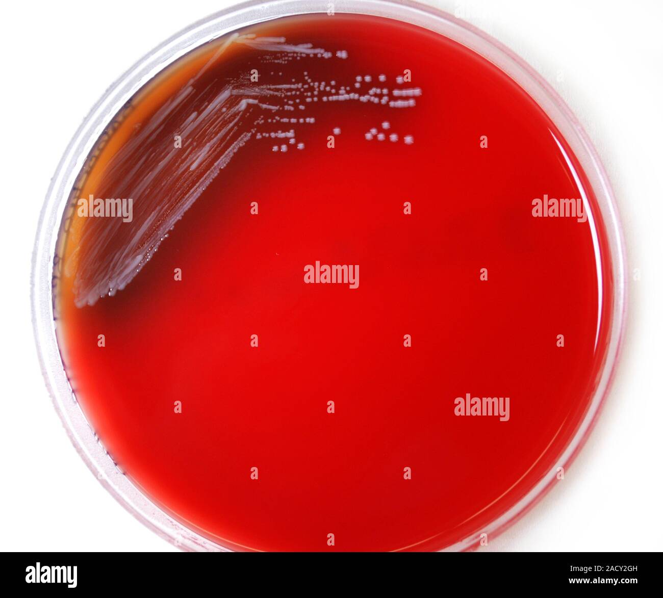 Yersinia Pestis Blood Agar