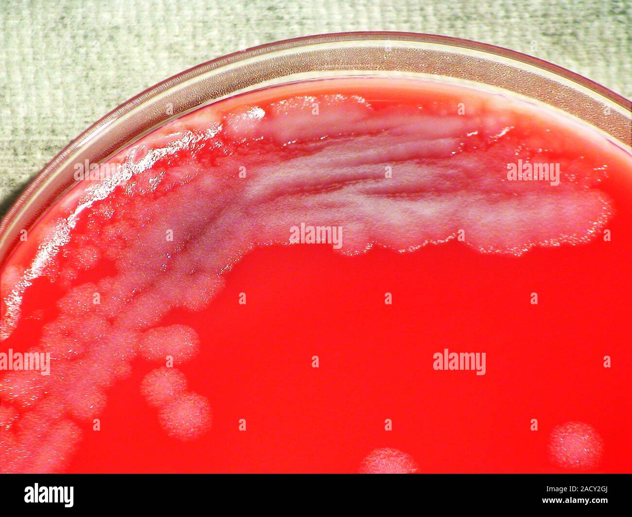 Anthrax bacteria culture. Petri dish containing phenylethyl alcohol ...