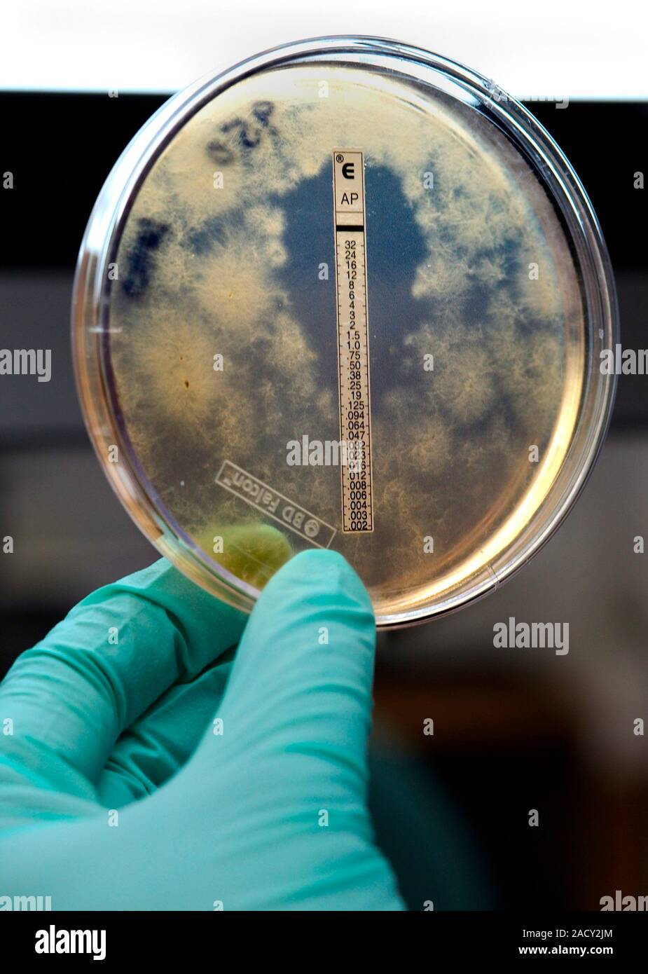 Fungal meningitis research. Image showing a test to determine the ...