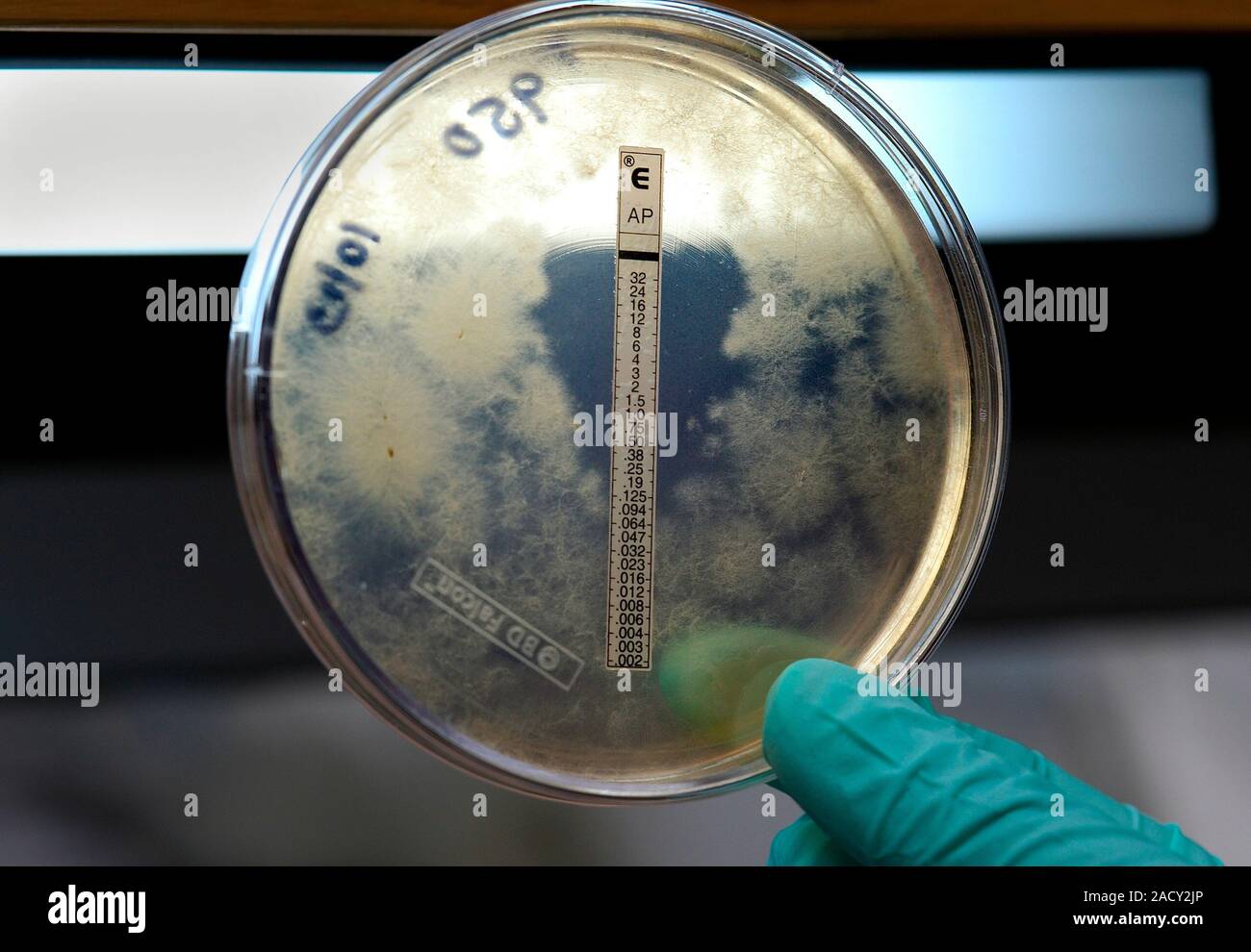 Fungal meningitis research. Image showing a test to determine the ...