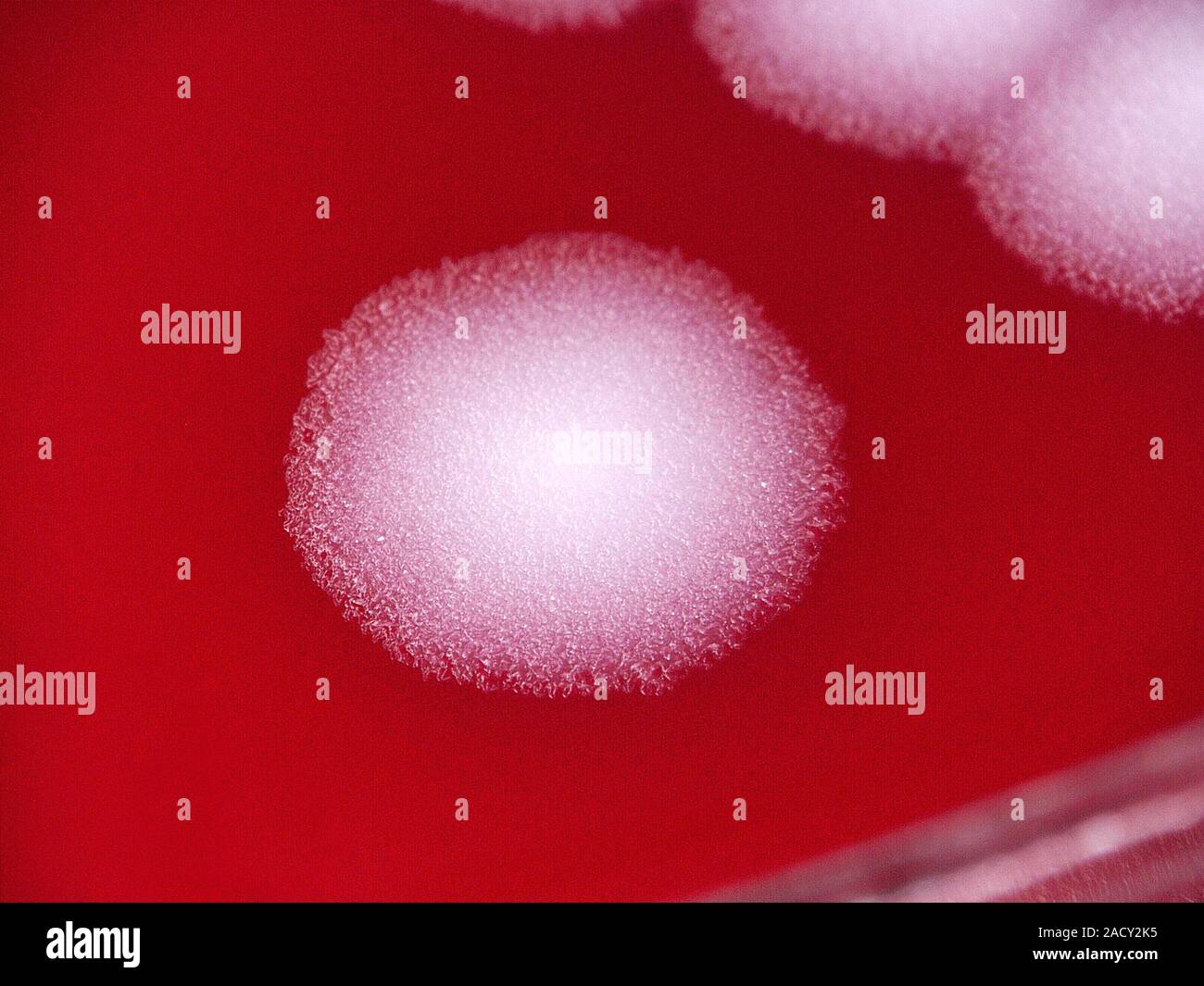 Anthrax bacteria culture. Close-up of a Petri dish containing blood ...