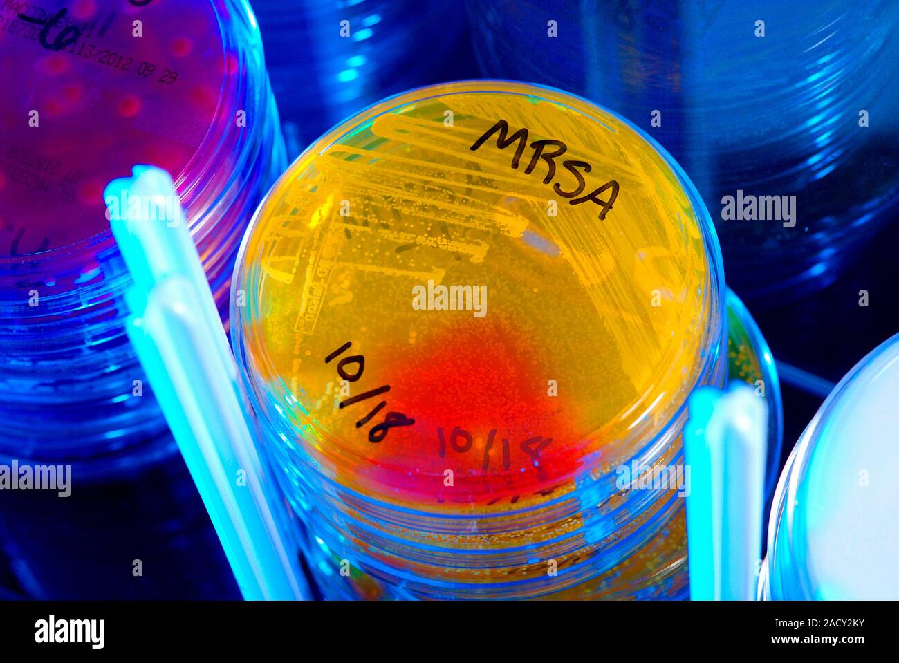 MRSA bacteria culture. Petri dish culture plates that have been ...