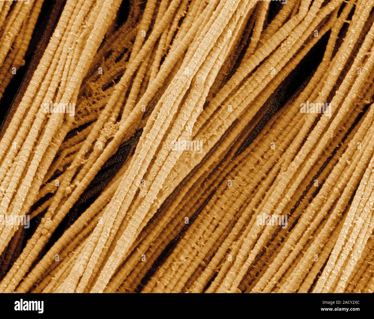 Collagen fibrils. Coloured scanning electron micrograph (SEM) of a ...