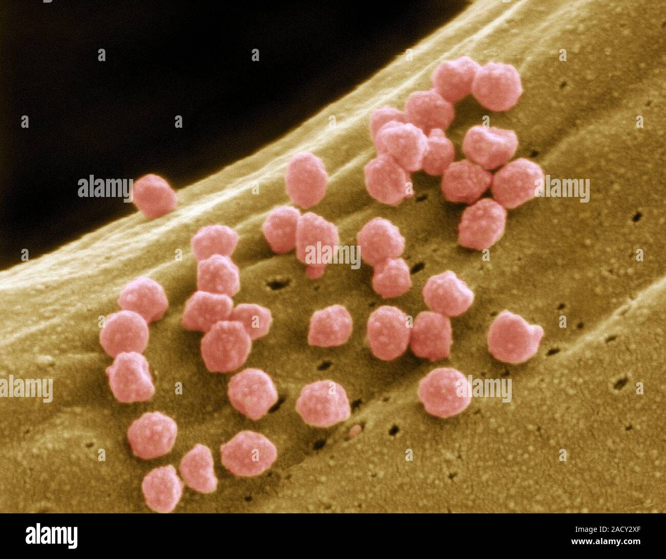 Cell infected with HIV. Coloured scanning electron micrograph (SEM) of ...