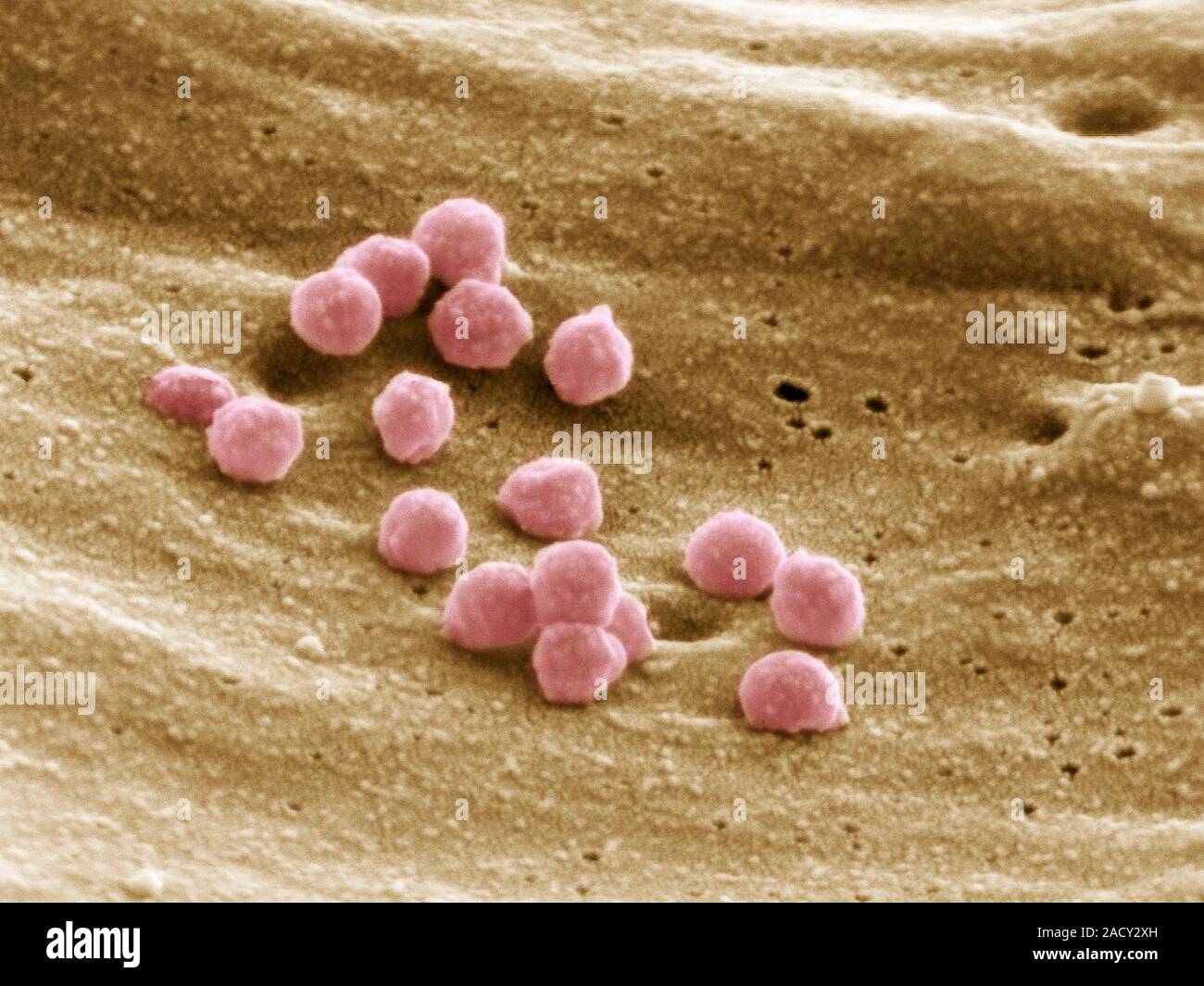 Cell infected with HIV. Coloured scanning electron micrograph (SEM) of ...
