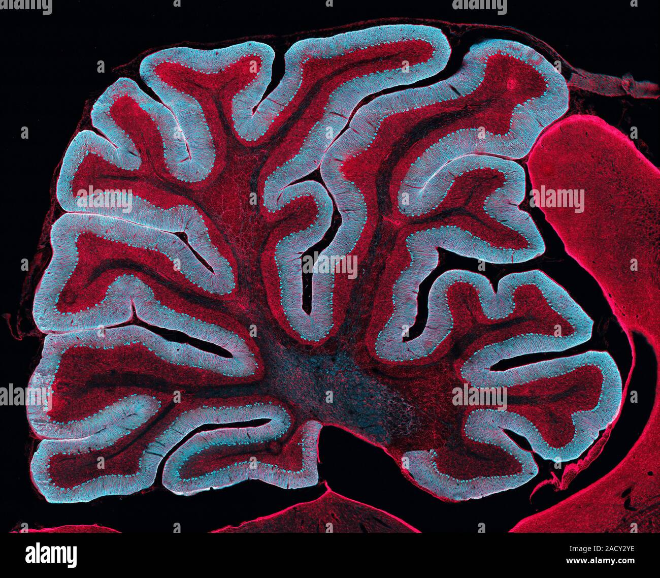 Cerebellum from a brain. Multiphoton fluorescence micrograph (MFM) of a ...