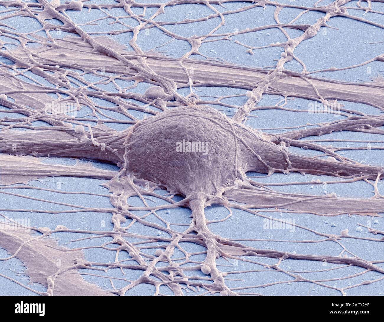 Stem cell-derived neuron. Coloured scanning electron micrograph (SEM ...