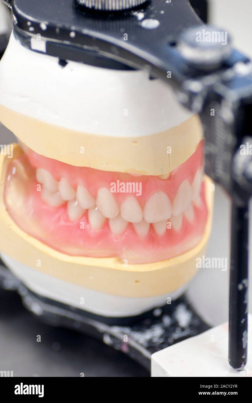 Dentures. Close-up of finished dentures on a mould Stock Photo - Alamy