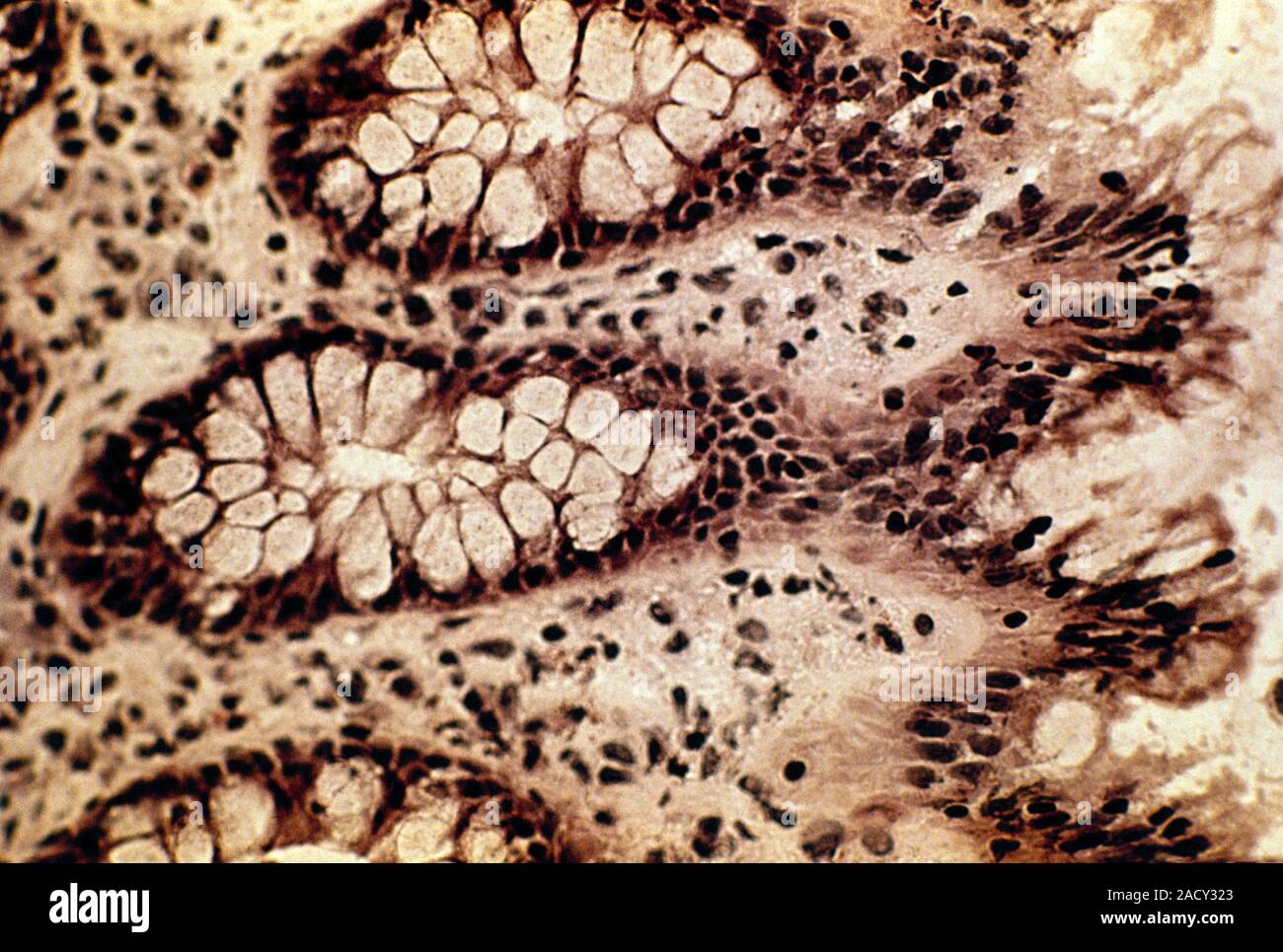 Colon lining. Light micrograph of a section through the lining (mucosa ...