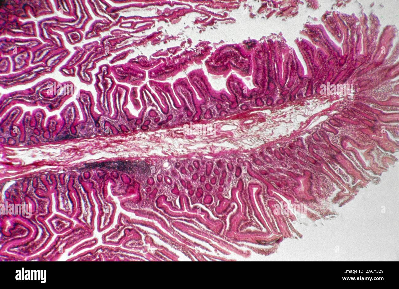 Intestinal villi. Light micrograph of a section through a villus ...