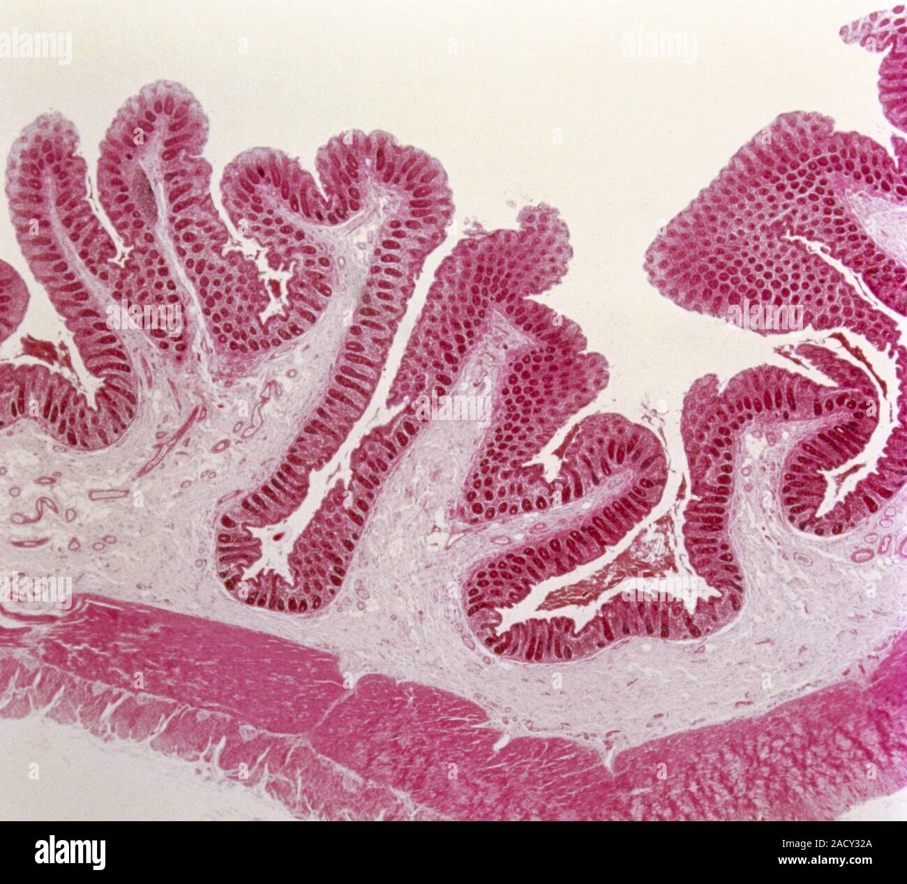 Intestinal villi. Light micrograph of a section through a villus ...