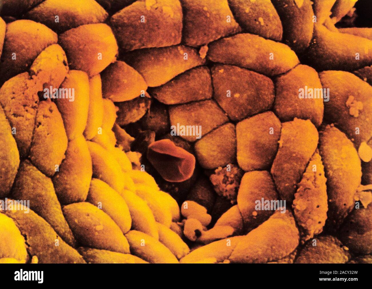 Stomach lining. Coloured scanning electron micrograph the lining of the ...