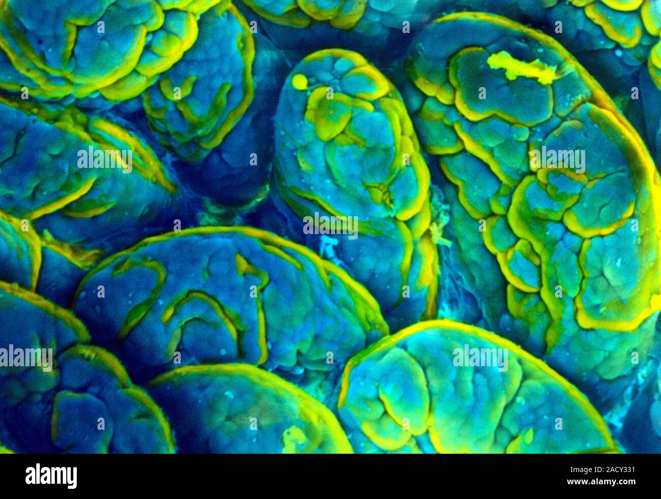 Small intestine lining. Coloured scanning electron micrograph (SEM) of ...