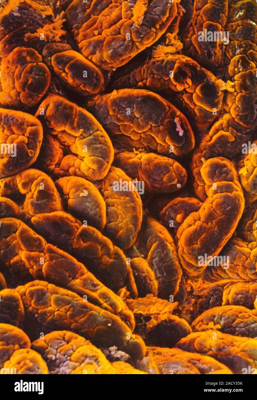Intestinal Lining Coloured Scanning Electron Micrograph Sem Of Villi From The Small Intestine