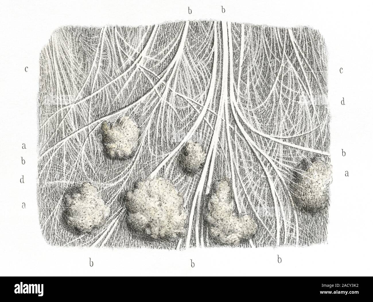 Lip anatomy. 19th century artwork of the mucous membrane of the lower ...