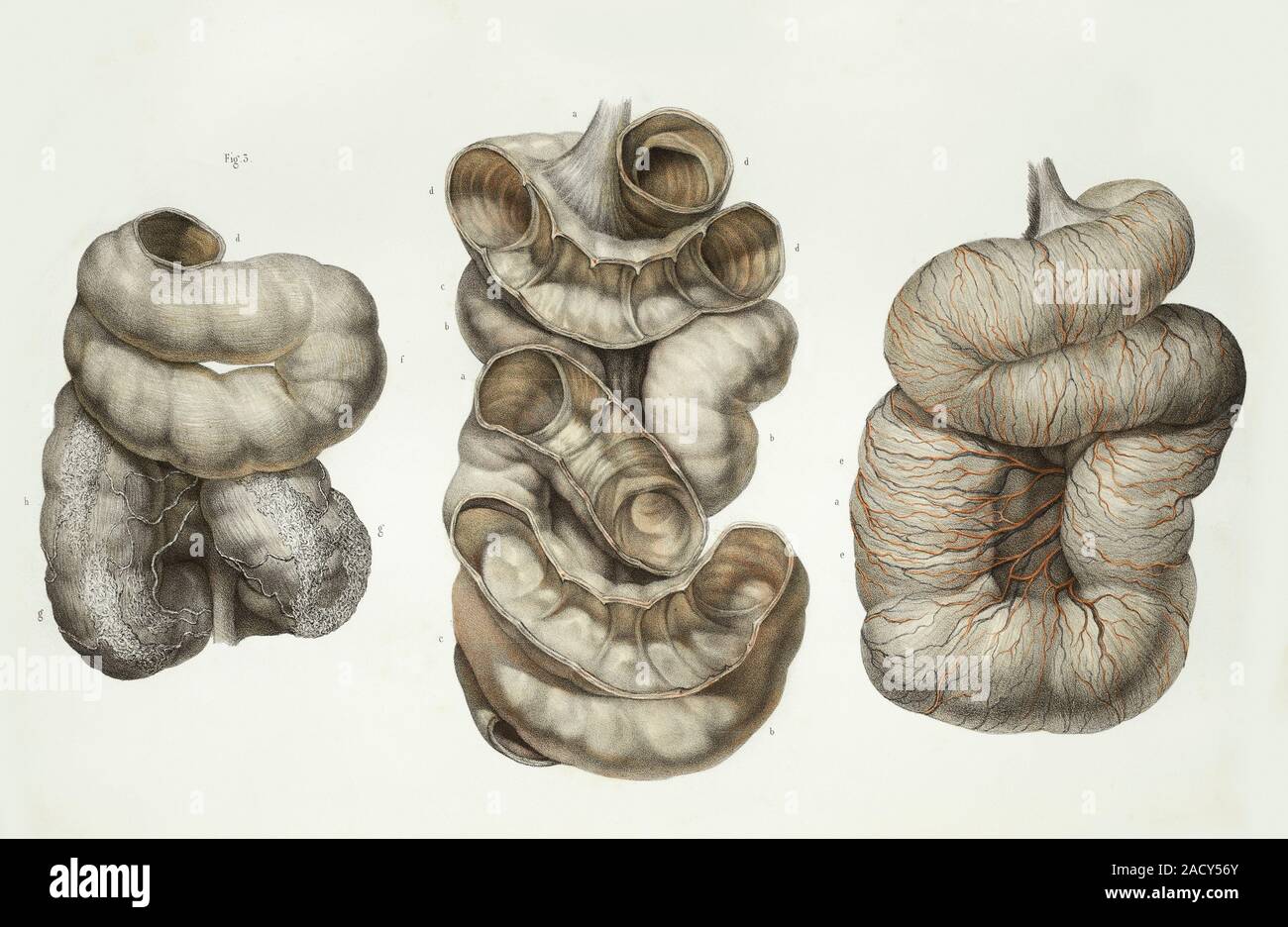 Small intestine. 19th century artworks of the small intestine showing ...