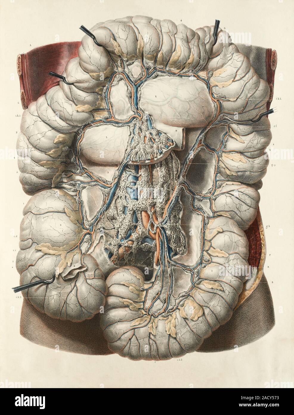Large intestine. 19th century artwork showing the lymph vessels (white ...