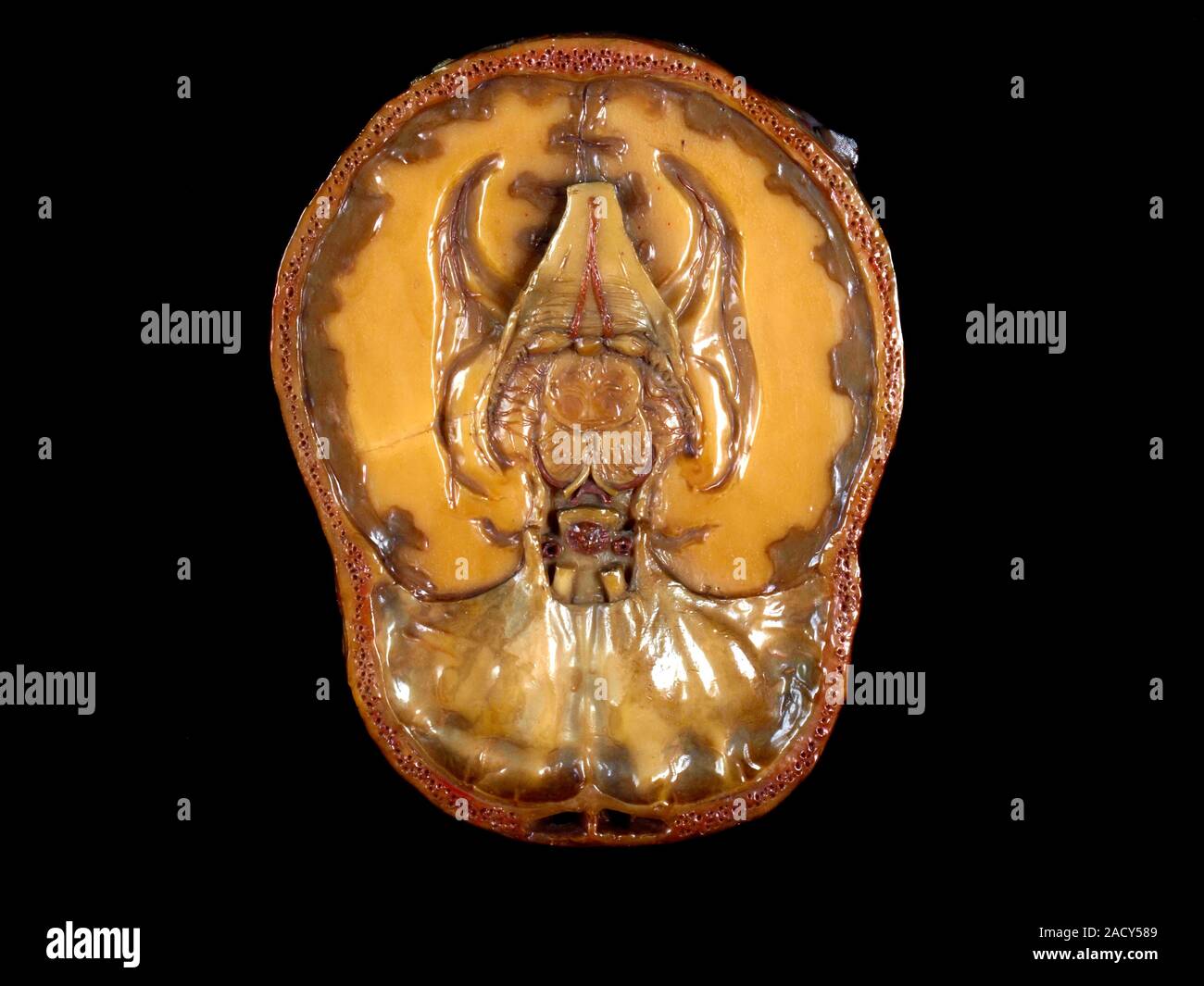 Brain model. 18th-century wax model of an anatomical dissection of a ...
