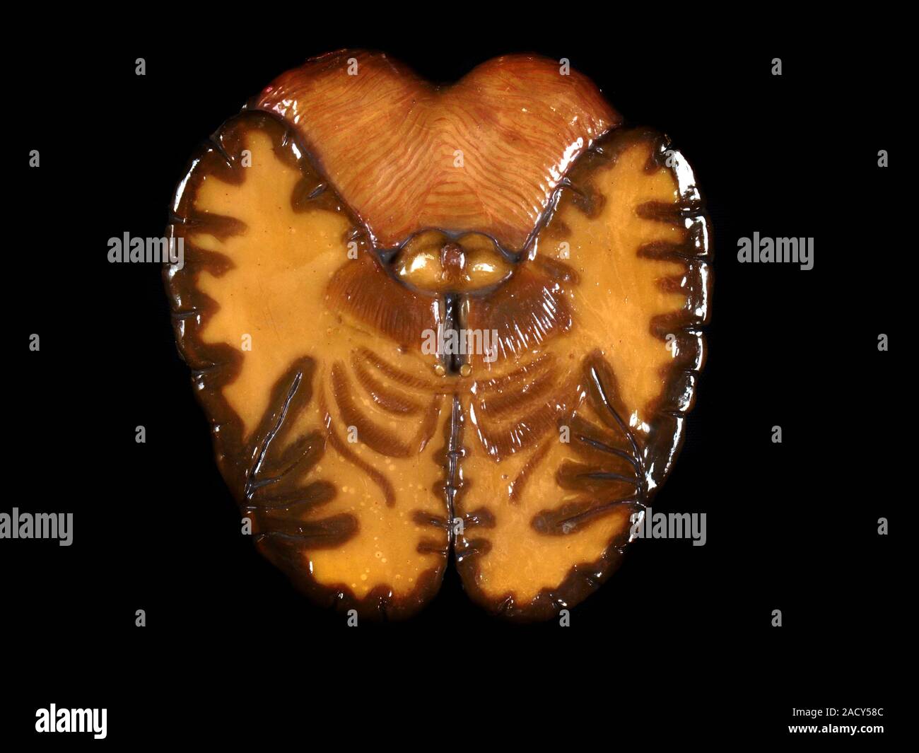 Brain model. 18th-century wax model of an anatomical dissection of a ...